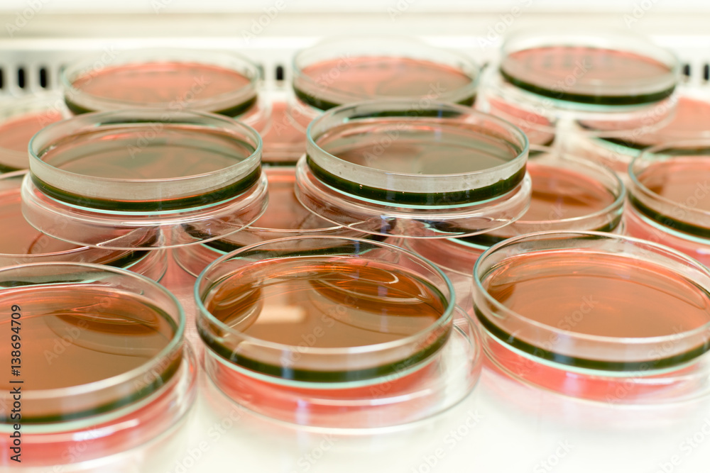 Eosin Methylene Blue (EMB) Agar for culture medium for Inoculum tests ...