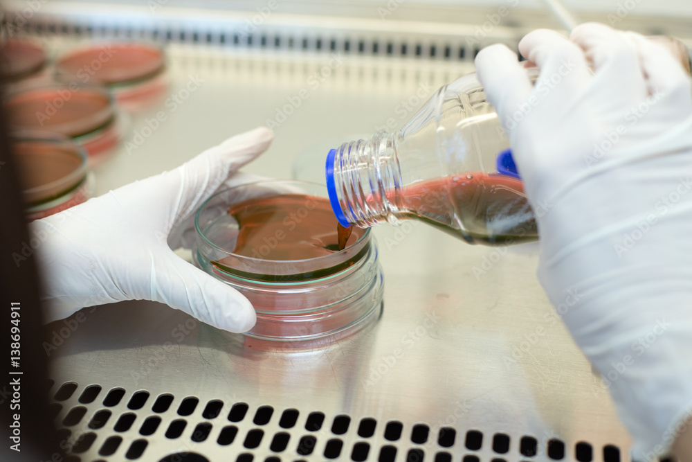 Eosin Methylene Blue (EMB) Agar for culture medium for Inoculum tests ...