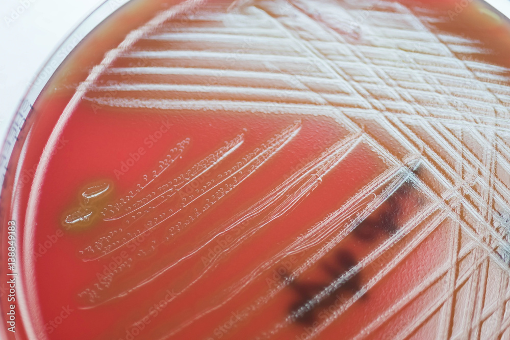 Poster Streptococcus suis; Gram-positive, to Gram-variable, nonmotile ...