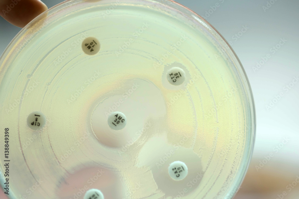 Keyhole test ESBLs positive by diffusion method test for gram negative ...