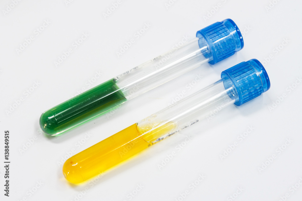 .TSI positive and negative for biochem test for bacteria; biochemical ...