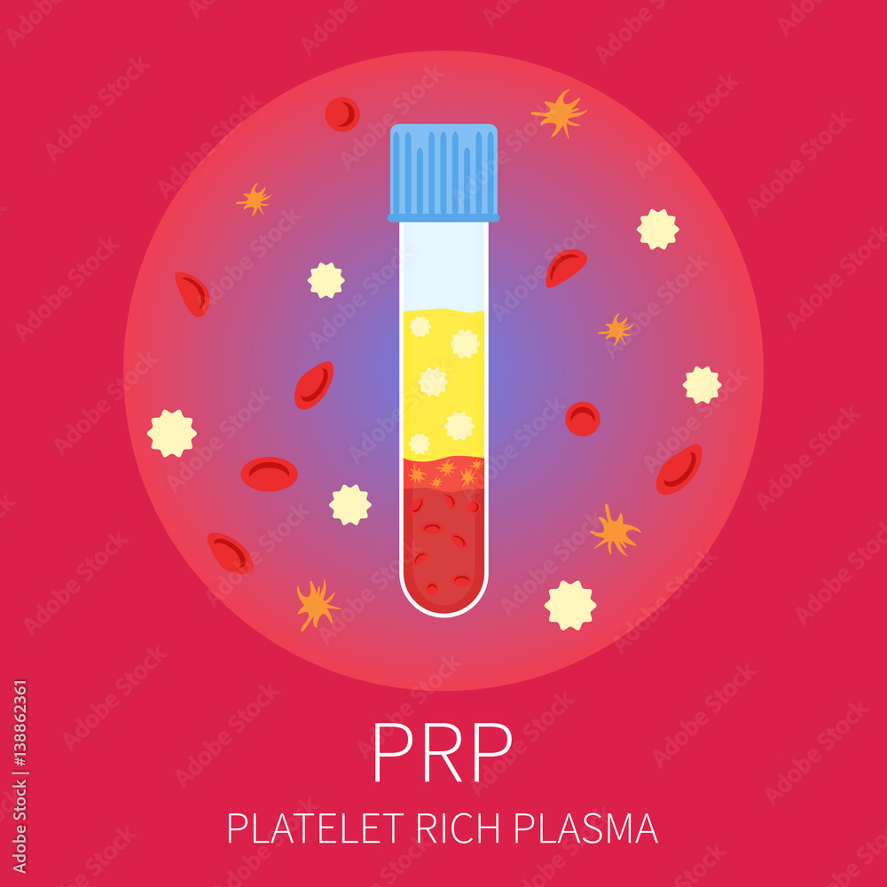 Test tubing filled with blood for PRP procedure on red background ...