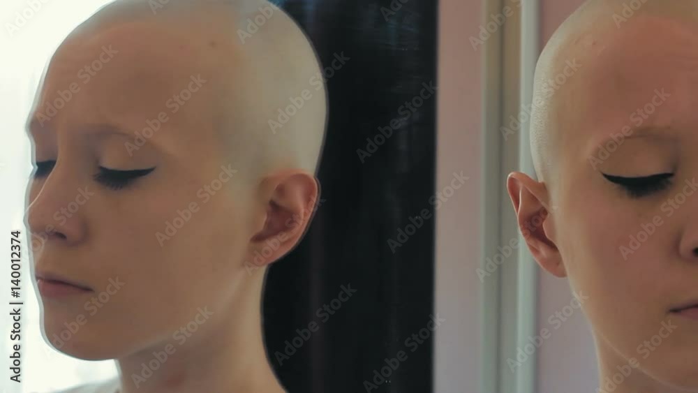 Sad woman in chemotherapy is concerned and worried Stock Video | Adobe ...