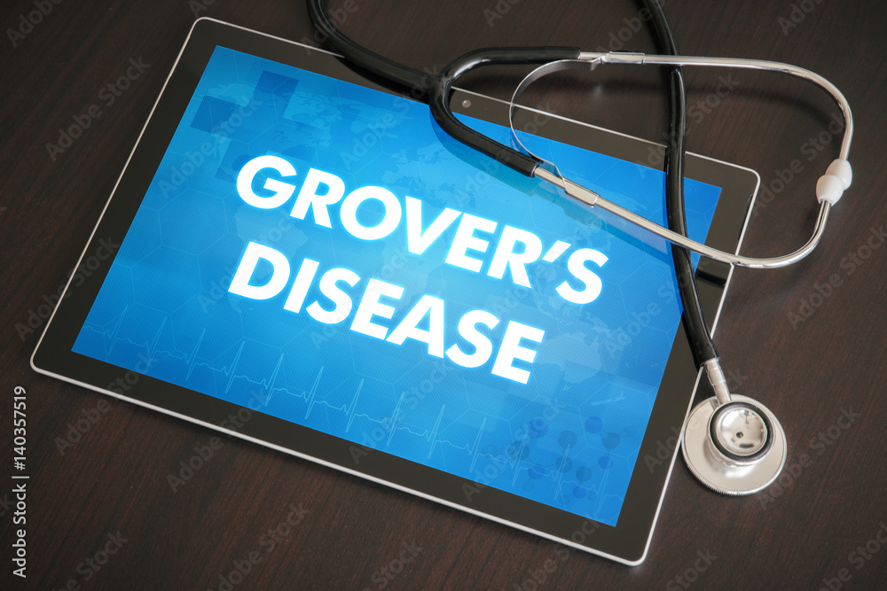 Grover's disease (cutaneous disease) diagnosis medical concept on ...