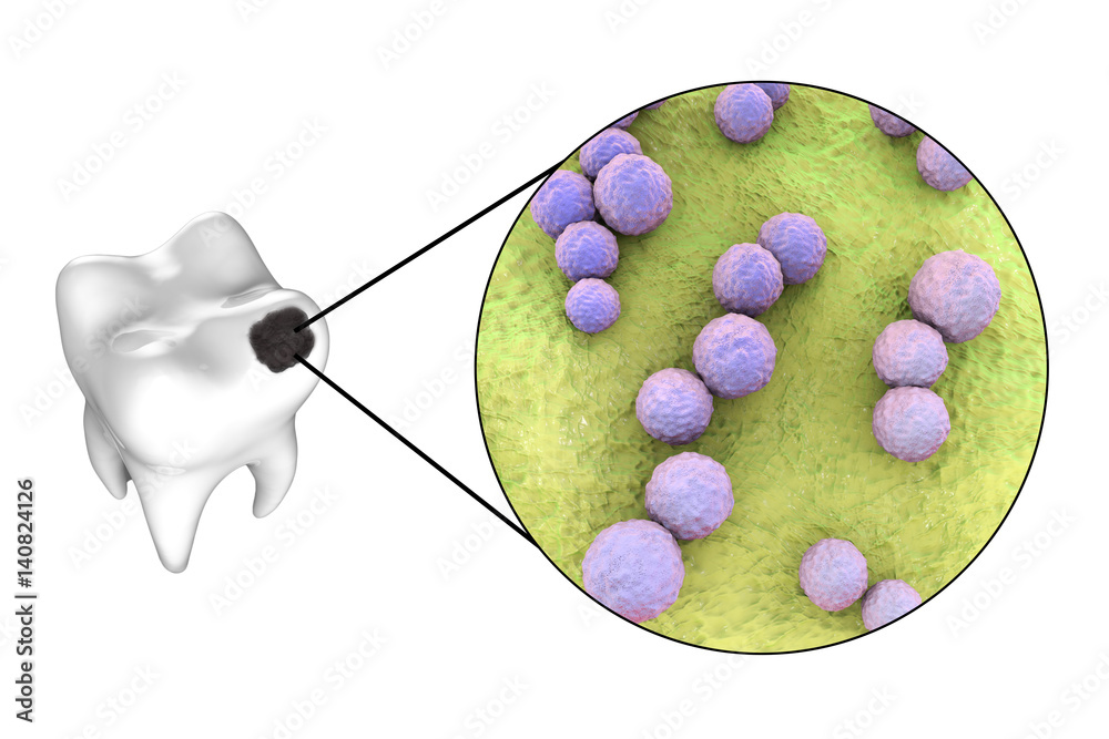 Streptococcus Mutans