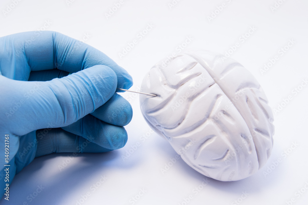 Concept of biopsy of brain tissue. Surgeon holding puncture needle and ...