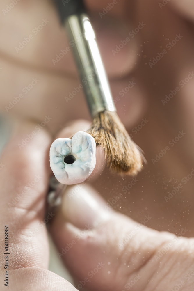 Dental prosthesis, artificial tooth, prosthetic, hands working on the ...