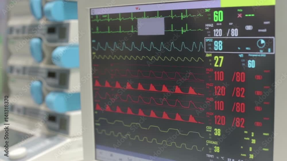 Medical screen that displays the parameters of the heart Stock Video ...