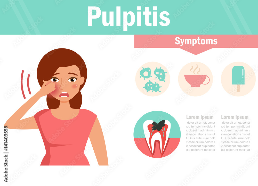 Pulpitis. Dental disease Stock Illustration | Adobe Stock