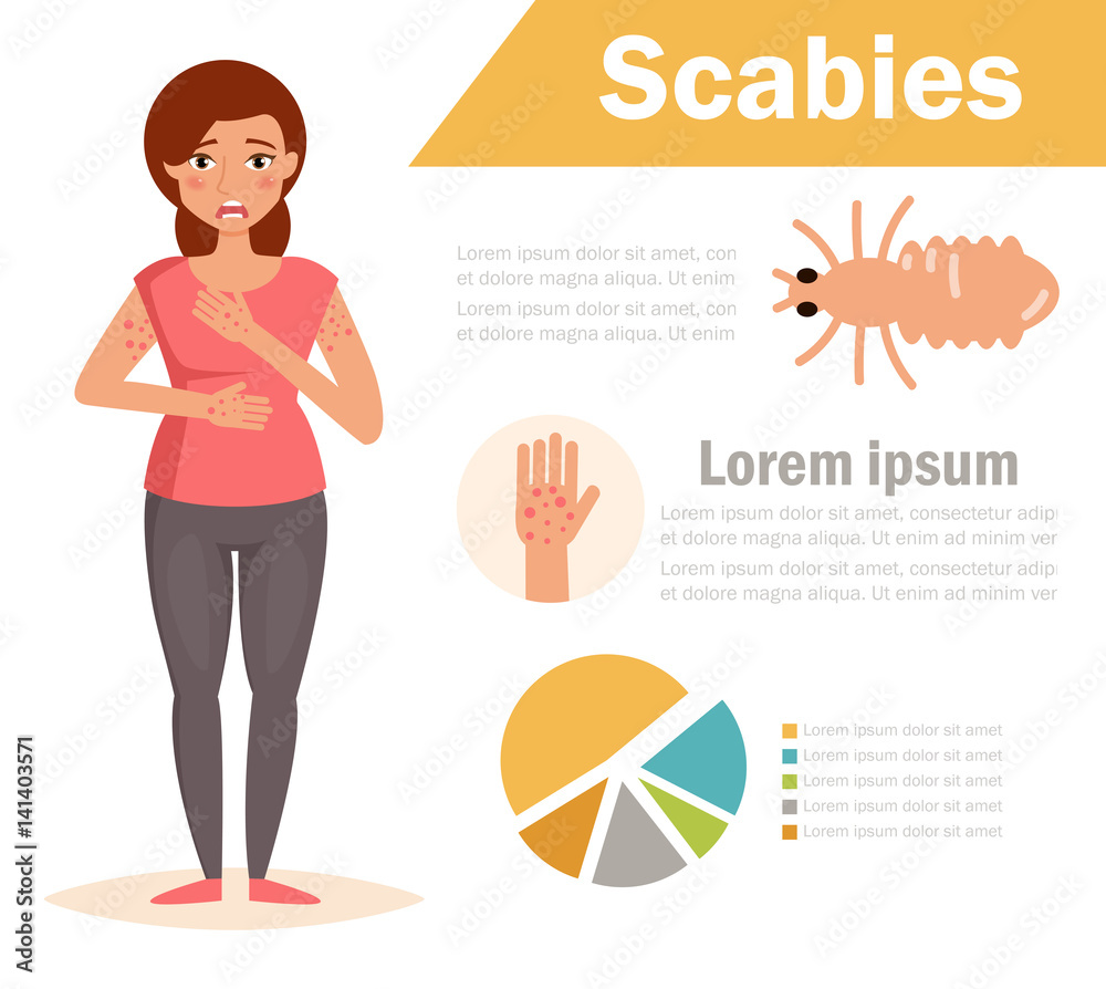 Scabies. Isolated art Stock Illustration | Adobe Stock