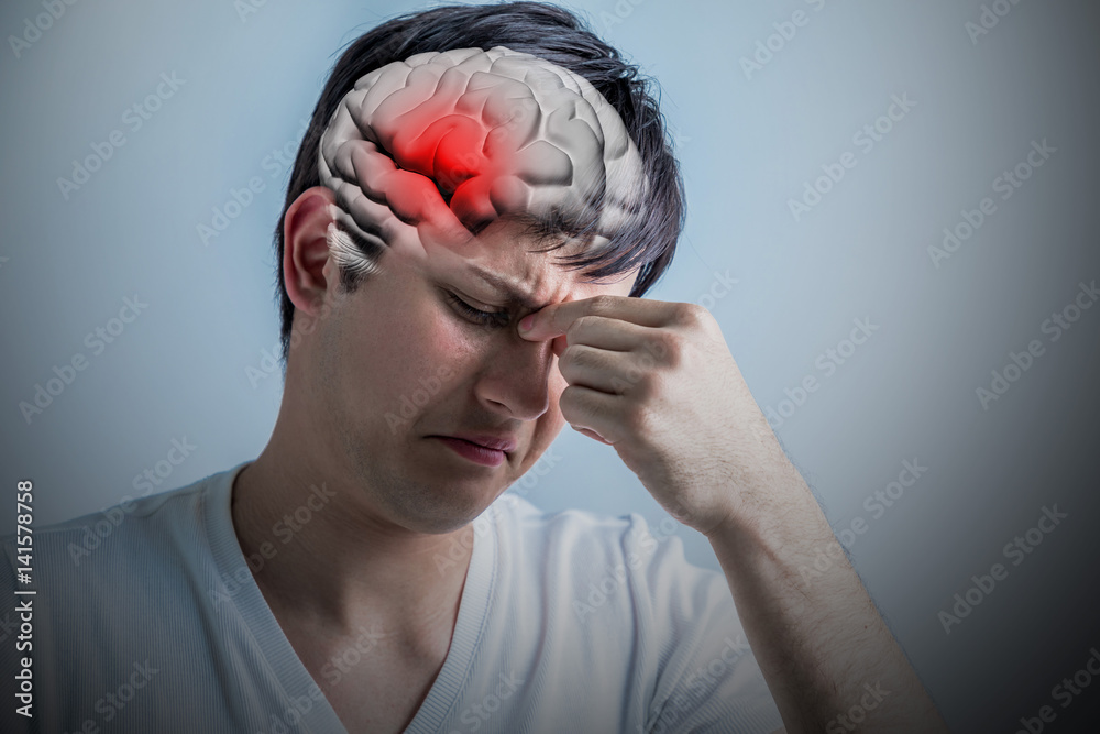 brain stroke concept, headache, cerebral hemorrhage, 3D rendering Stock ...