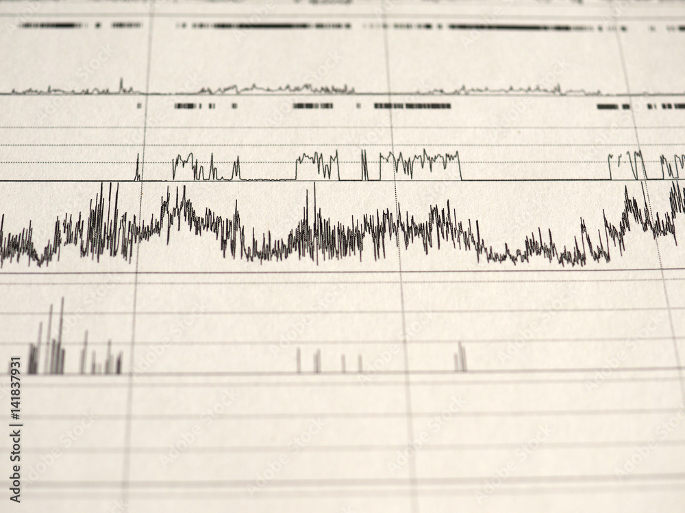 polysomnography (PSG) sleep study Stock Photo | Adobe Stock