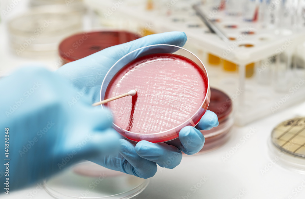 lab technician hand planting a petri dish Stock Photo | Adobe Stock lab technician hand planting a petri dish Stock Photo | Adobe Stock