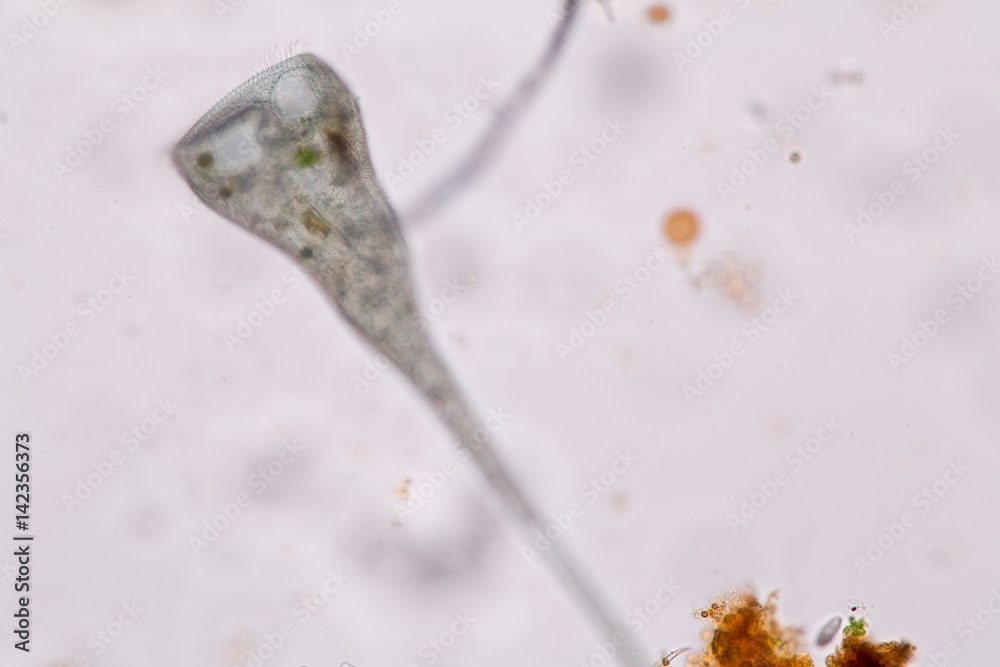 Stentor (ciliate) in waste water under the microscope. foto de Stock ...