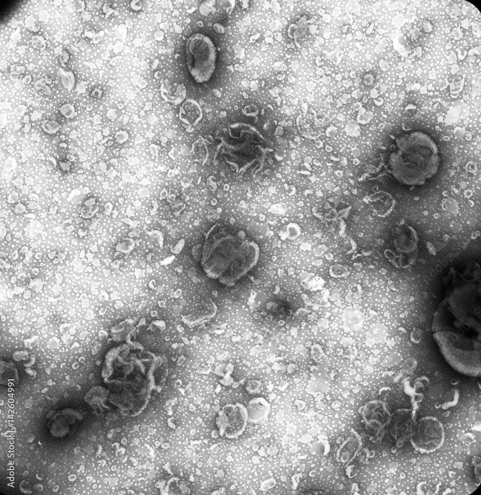 Liposomi osservati al microscopio elettronico Stock Photo | Adobe Stock