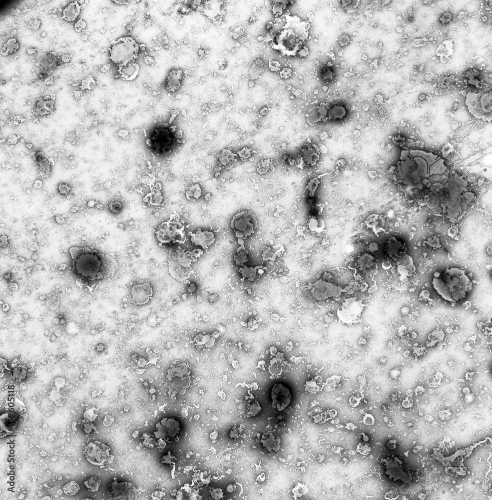 Liposomi osservati al microscopio elettronico Stock Photo | Adobe Stock