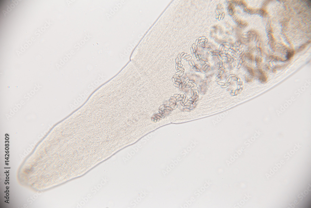 parasite under microscope view. Stock Photo | Adobe Stock