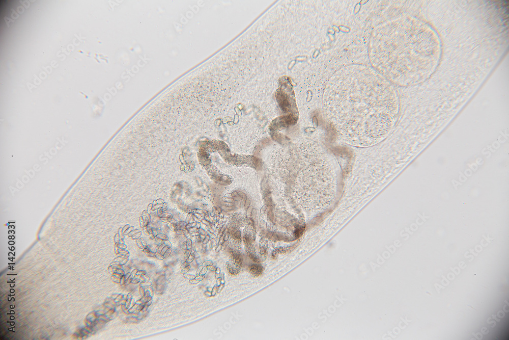 parasite under microscope view. Stock Photo | Adobe Stock