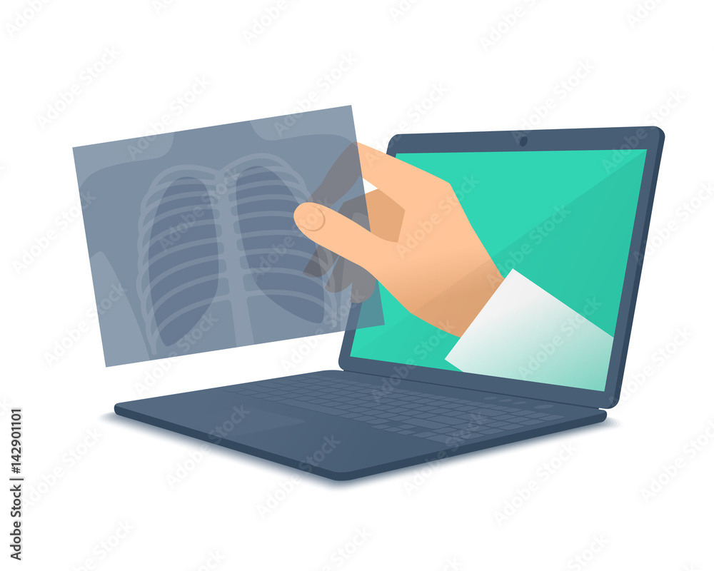Laptop, doctor's hand holding an x-ray image. Medic through the ...