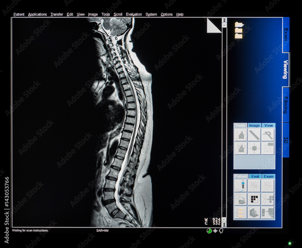 Mri Scan Monitor Stock Photo | Adobe Stock