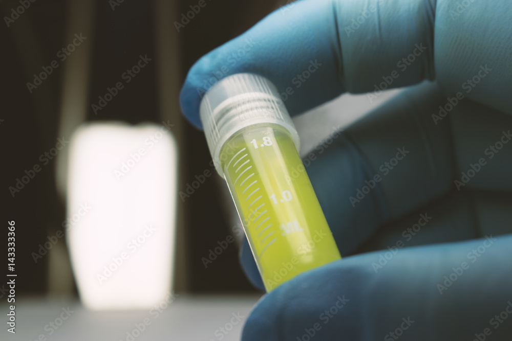 Gloved Hand Holding Research Vial, Stem Cell Research Substance in Vial ...