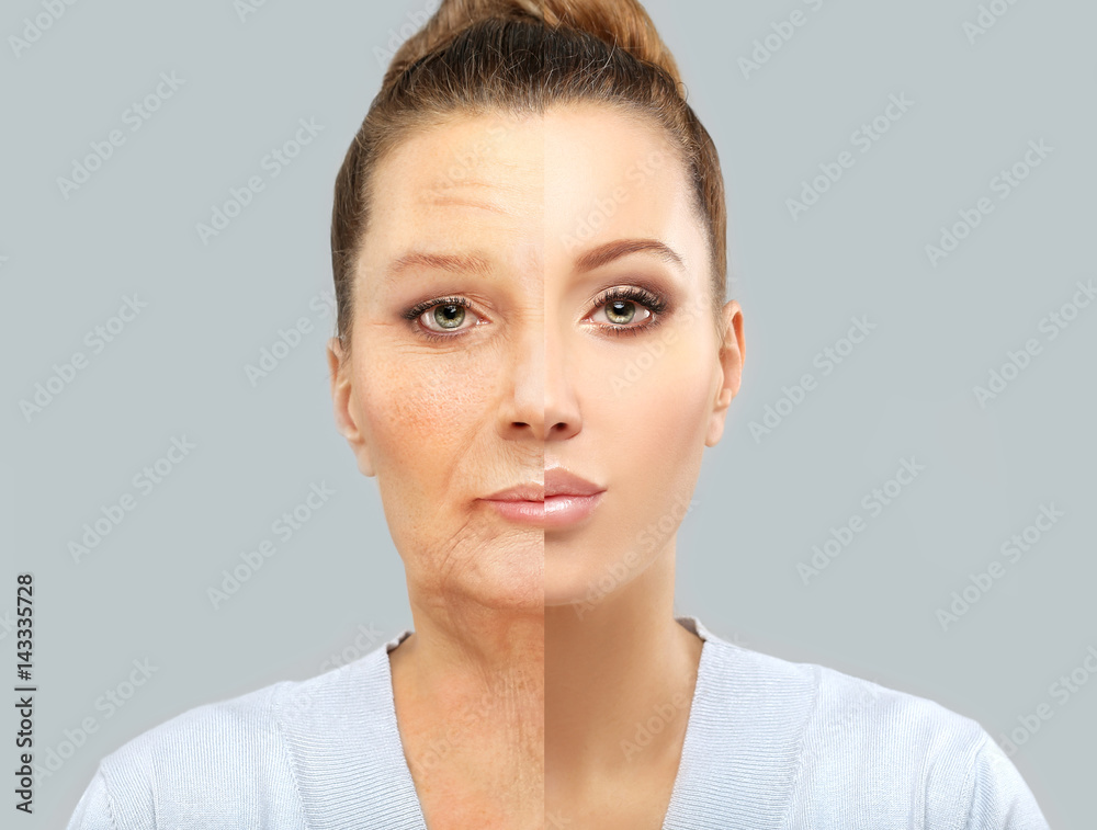 Aging. Mature woman-young woman.Face with skin problem Stock Photo ...