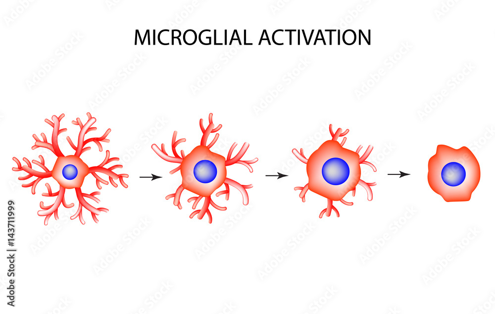 Activation of microglia. Neuron. Nerve cell. Infographics. Vector ...