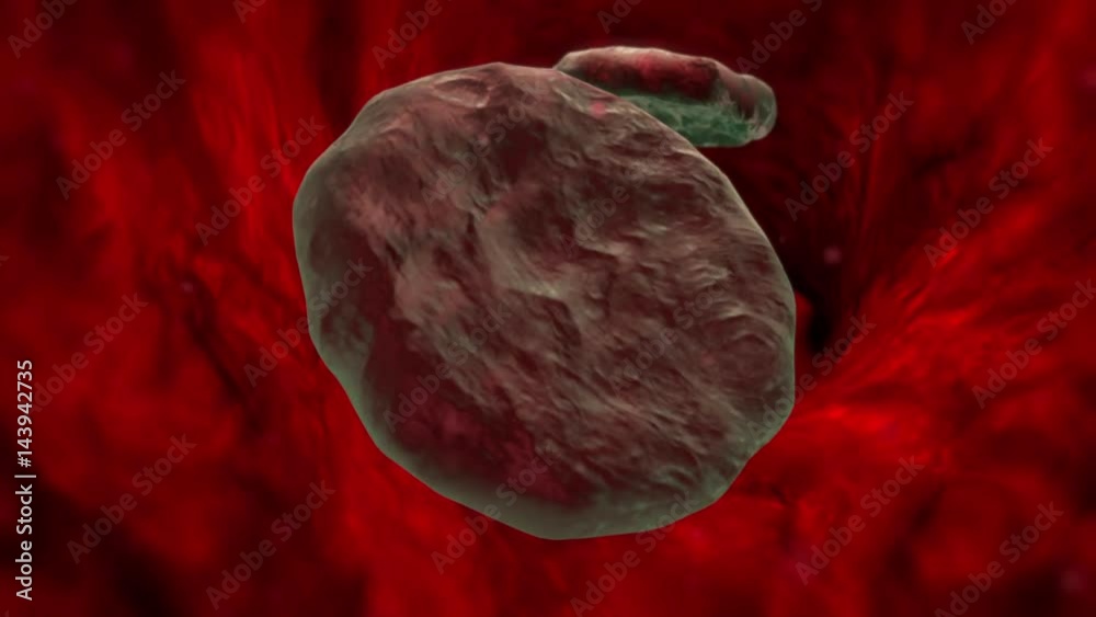 Mutating blood cell. AIDS. Blood cancer (oncology, leukemia, anemia ...