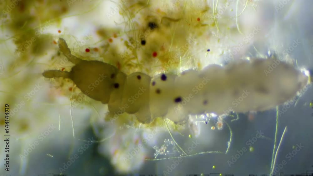 Insect Nymph 100x Microscope View. Insect is tangled on moss sample ...