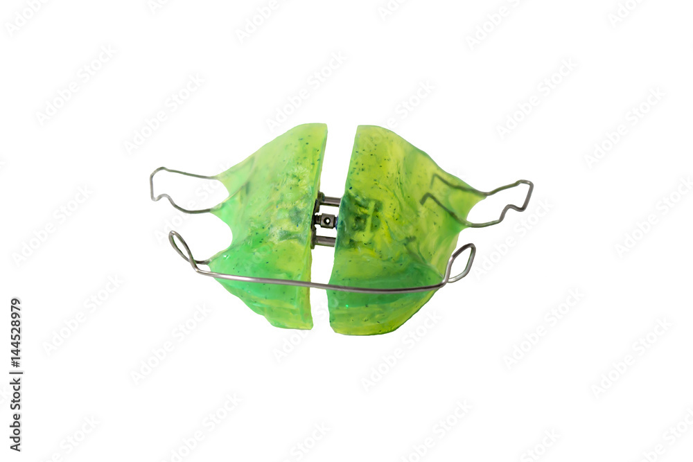 Orthodontic two jaw apparatus - a plate on the lower and upper jaw for ...