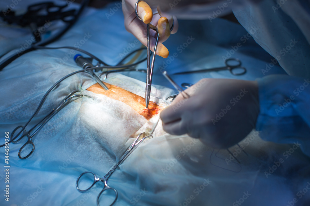 Vet doing the operation for sterilization. The cat on the operating ...