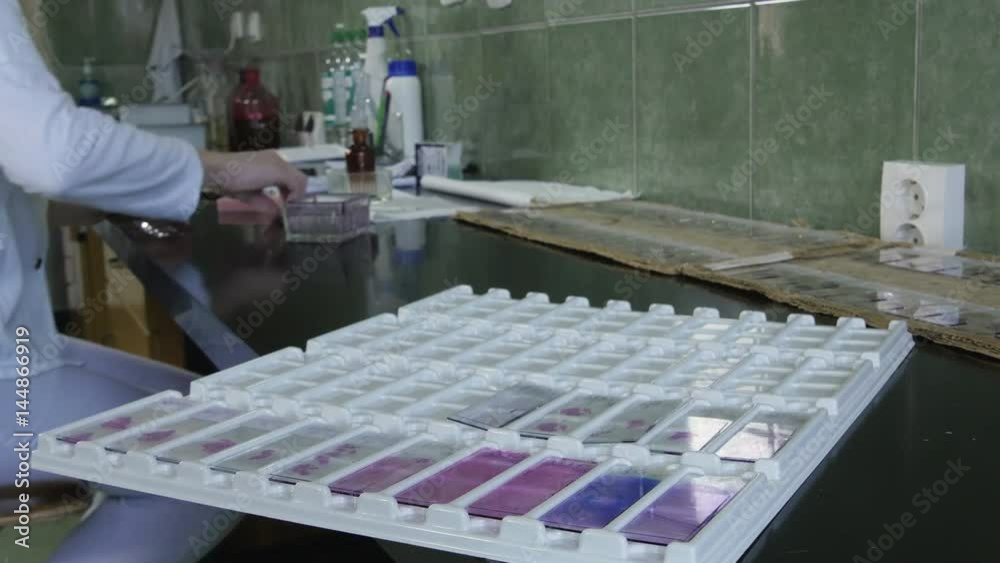 A tissue samples on the glass plates in focus, close up, hands of ...