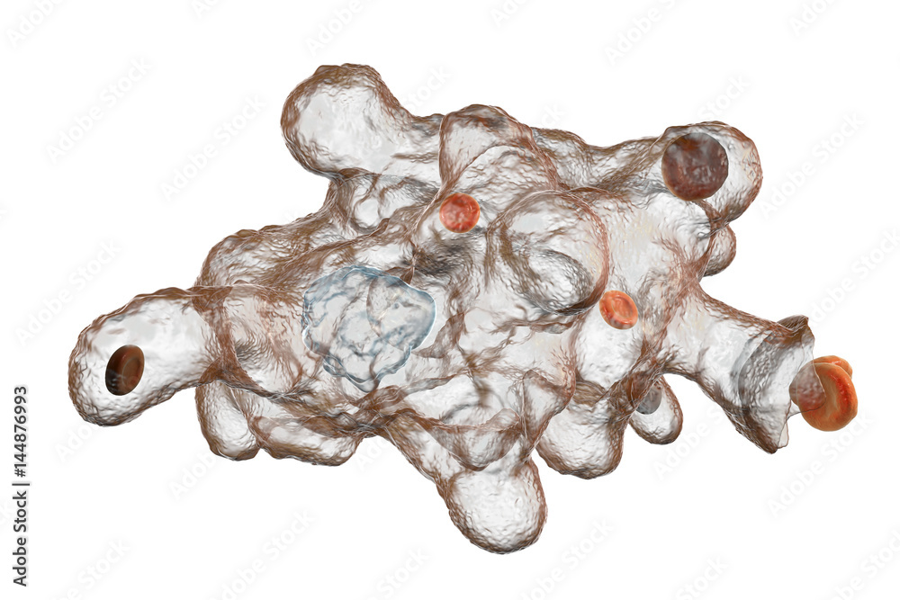 Entamoeba histolytica protozoan engulfing red blood cells. Parasite ...