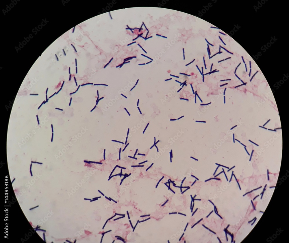 Staphylococcus Gram Stain 100x