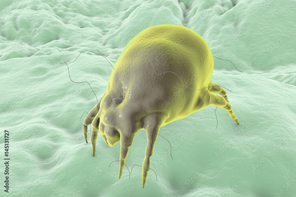Dust mite Dermatophagoides which lives in dust and furniture and whose ...