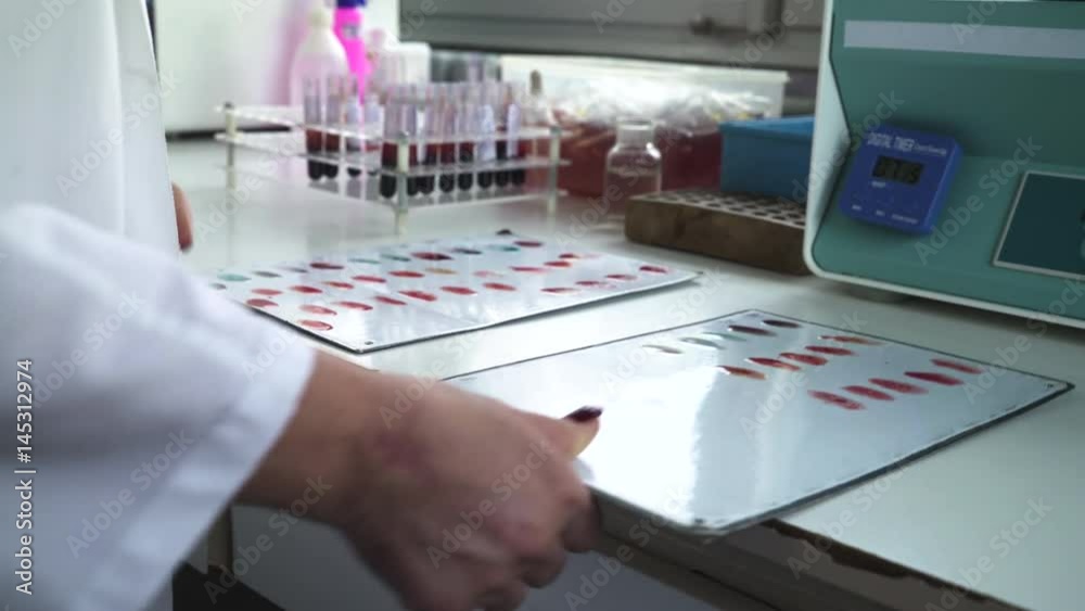 Technicians mixing samples on the plate for determination blood types ...