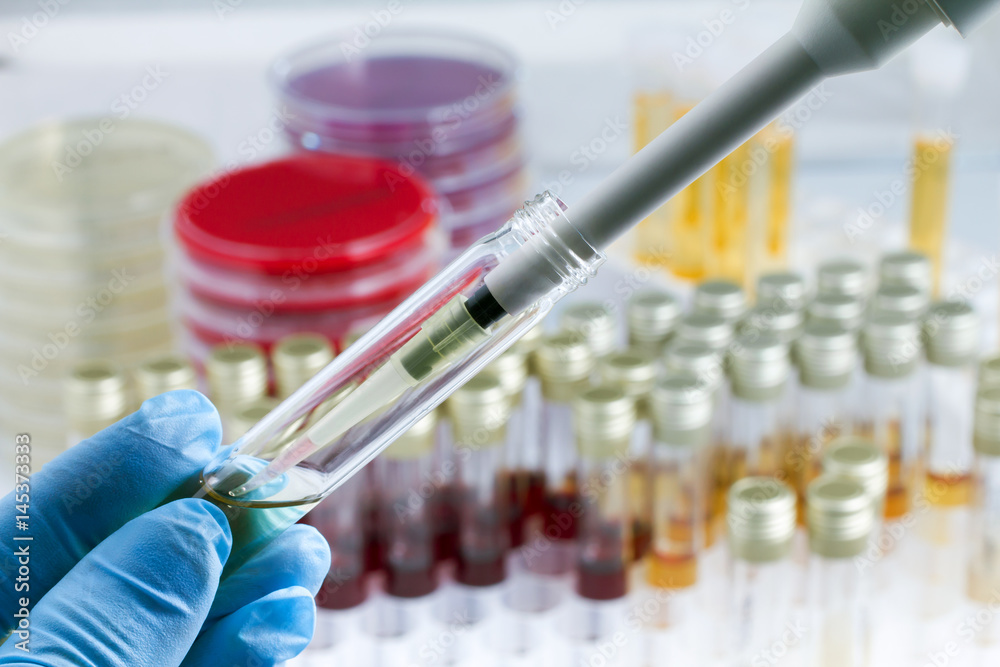 hand with pipette dropping sample Into Culture Medium tube / Hand of ...