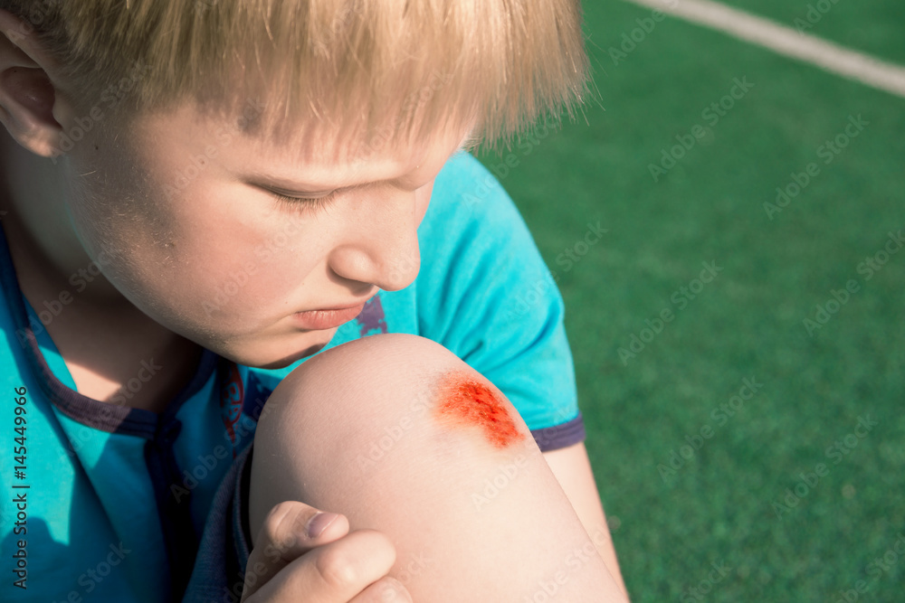 Boy with a scraped knee Stock-Foto | Adobe Stock