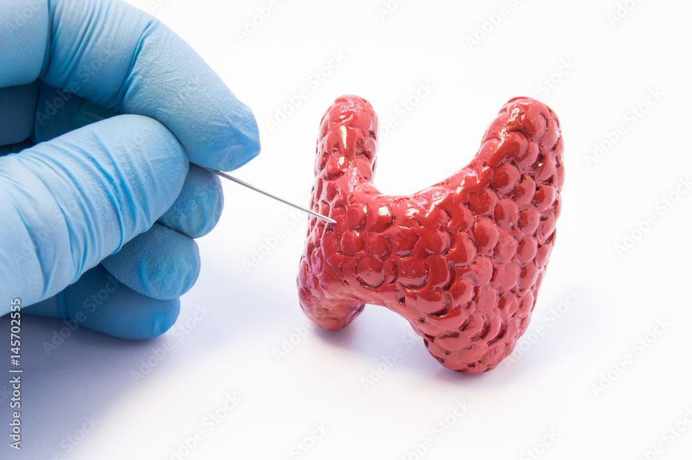 Biopsy of thyroid gland procedure. Doctor hold puncture needle in hand ...
