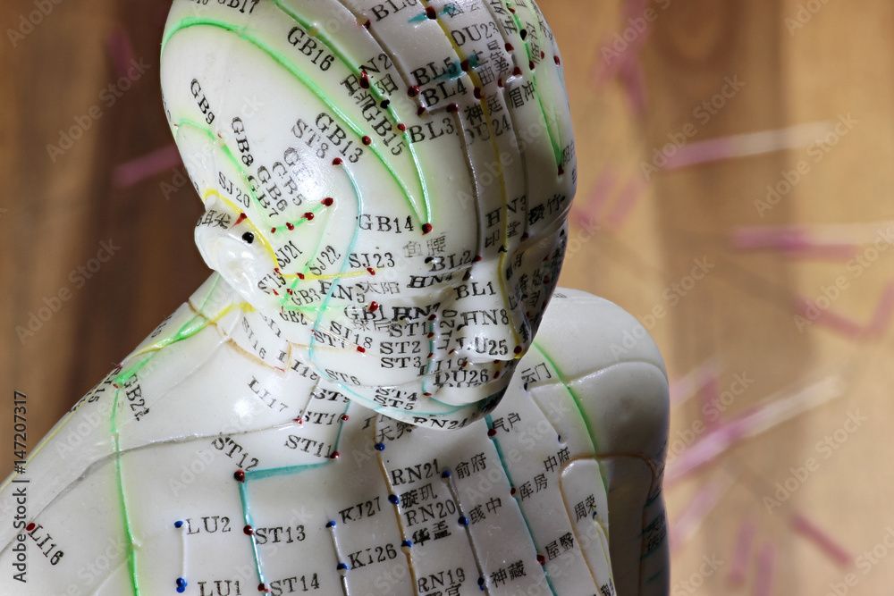 female acupuncture model on desktop Stock Photo | Adobe Stock