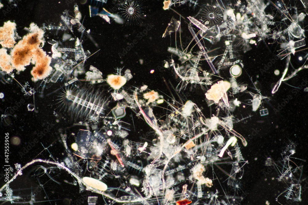 Chaetoceros (Diatom) under microscope view. Stock Photo | Adobe Stock