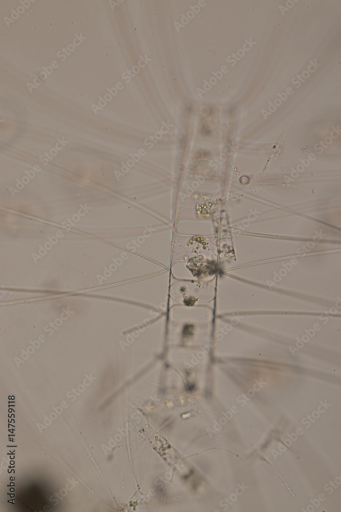 Chaetoceros (Diatom) under microscope view. Stock Photo | Adobe Stock