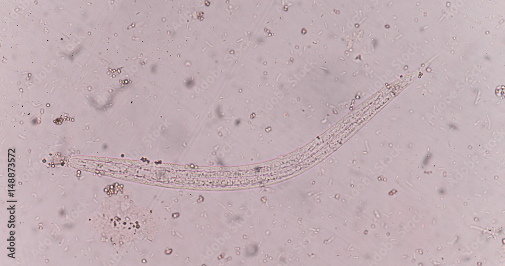 Strongyloides stercoralis (threadworm) in stool, Stock Photo | Adobe Stock