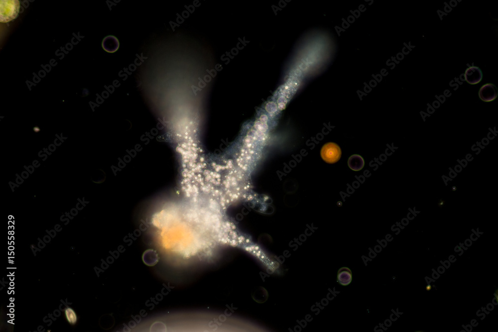Foto de Amoebae move and feed by using pseudopods, which are bulges of ...