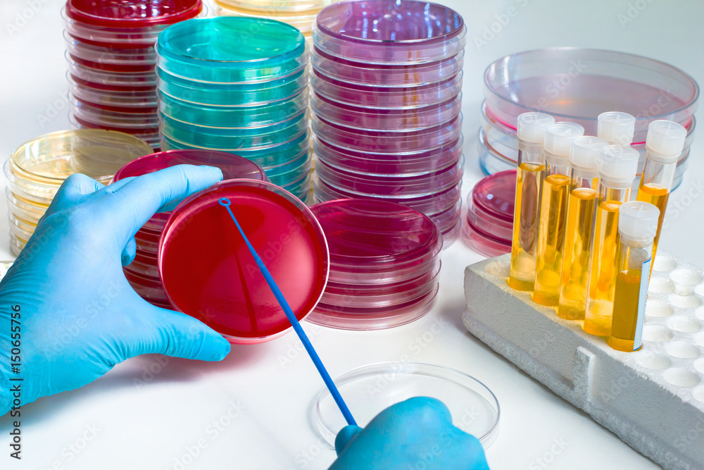 lab technician inoculating petri dish / hand of technician planting ... lab technician inoculating petri dish / hand of technician planting ...