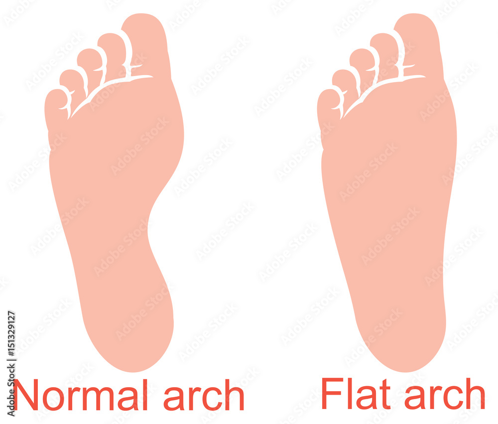 human anatomy - flat and normal arch vector illustration Stock Vector ...