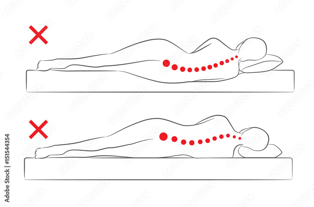 Fototapeta The Incorrect Spine Alignment When Sleeping By On The Side Fototapeta The Incorrect Spine Alignment When Sleeping By On The Side