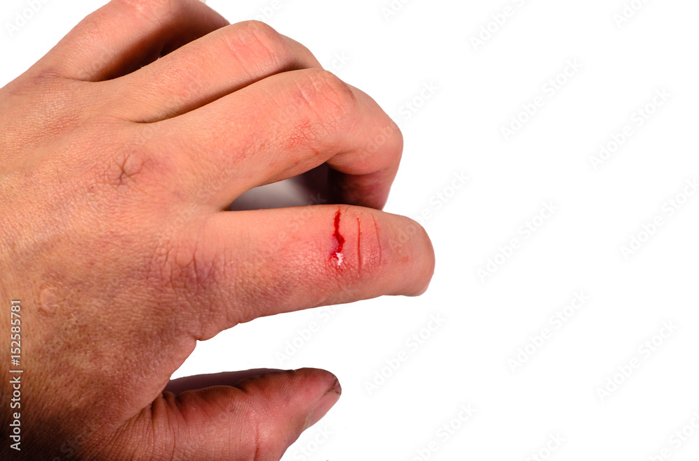 Male hand with bleeding finger isolated on white background Stock Photo ...