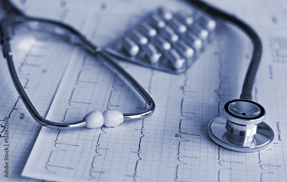 Poster electrocardiogram with stetoscope – Wall Art | UkPosters