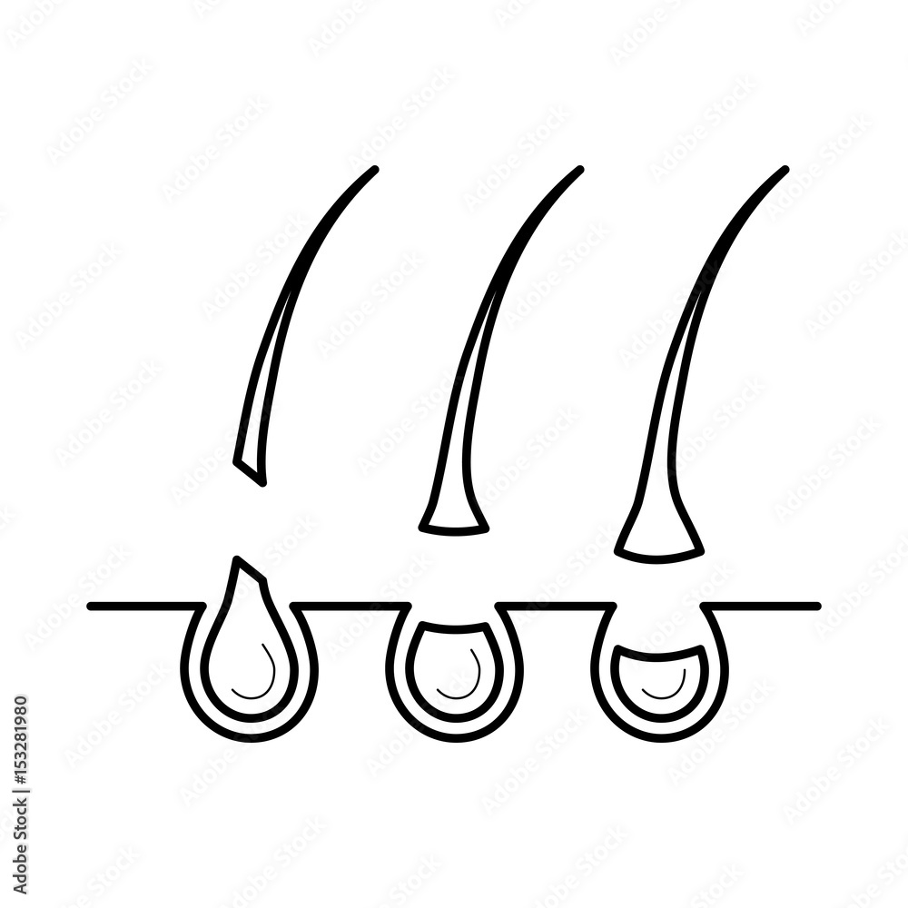 Hair removed from the skin surface without bulb, uneffective depilation ...